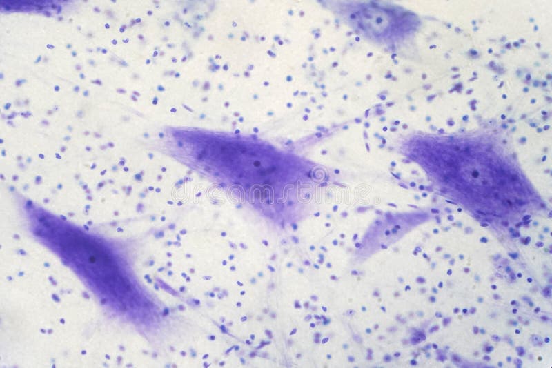 Cellules De Neurones Du Cerveau Sous La Vue De Microscope Photo stock ...