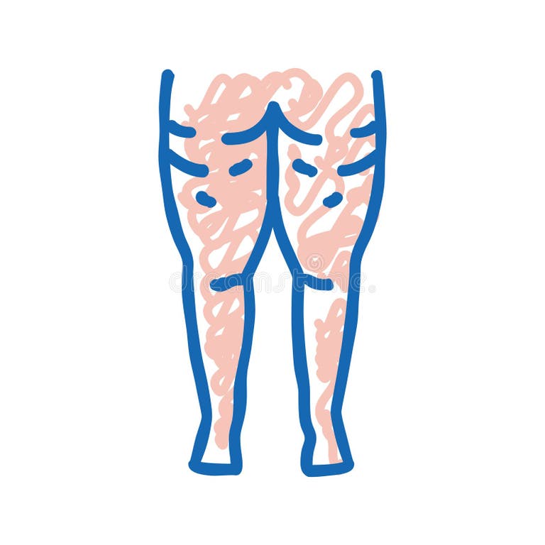 Cellulite Problem Icon Doodle Illustration Stock Illustration ...