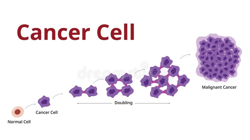 Process Of Cancer Cell Development. Medical Illustration. Stock Vector ...