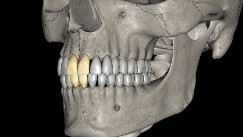 Maxillary and Mandibular Prosthesis with Gum All on 4 System Supported ...