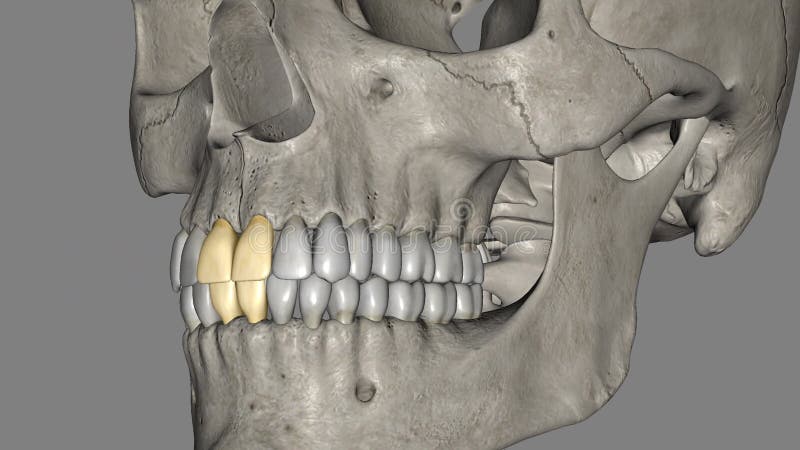 Maxillary and Mandibular Prosthesis with Gum All on 4 System Supported ...