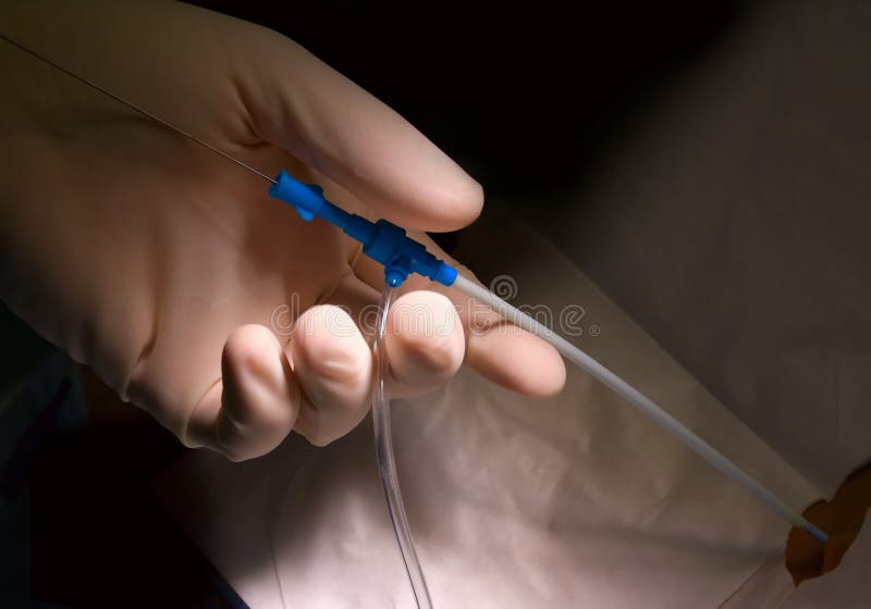 Central Vein Puncture and Catheterization Stock Photo - Image of health ...
