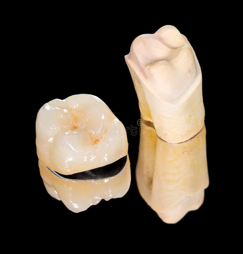 Ceramic crown stock photo. Image of esthetics, fixed - 44815152