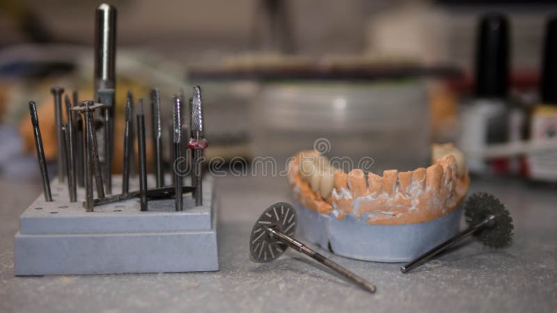 Ceramic Crown of a Tooth Based on a Plaster Model of Teeth, the Work of ...