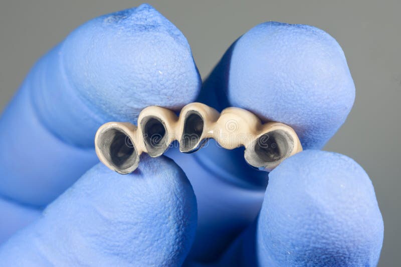 Ceramic Crowns of Human Teeth Closeup Macro Isolate on Black Background ...