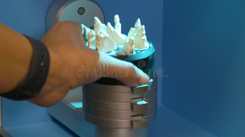 Scanning of Casts on a 3D Scanner for the Manufacture of Dentures ...
