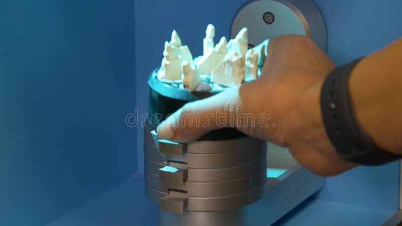 Scanning of Casts on a 3D Scanner for the Manufacture of Dentures ...