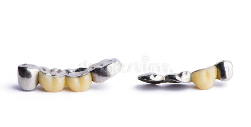 Ceramic Dentures. Isolated on White Background Stock Photo - Image of ...
