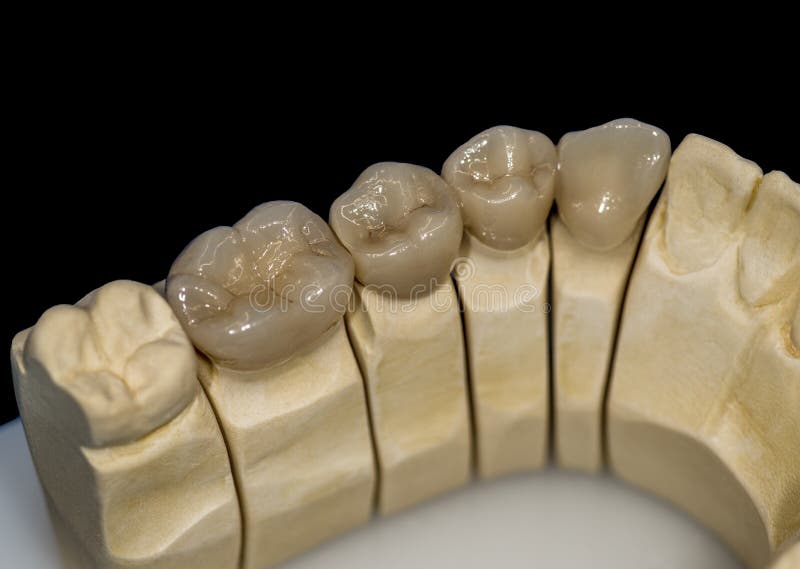 Ceramic Zirconium. Teeth. Dental Technician. Stock Image - Image of ...