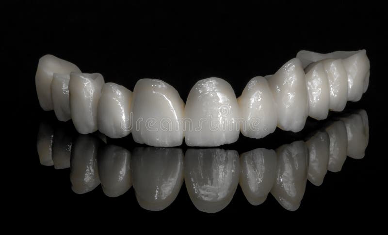 Ceramic Zirconium. Teeth. Dental Technician. Stock Image - Image of ...