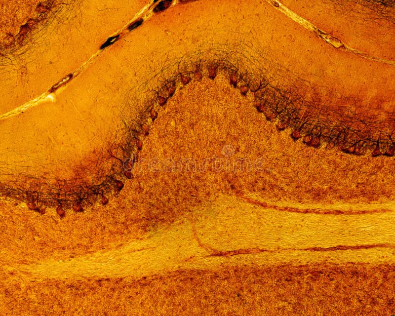 Cerebellar Cortex. Silver Stain Stock Image - Image of purkinje ...