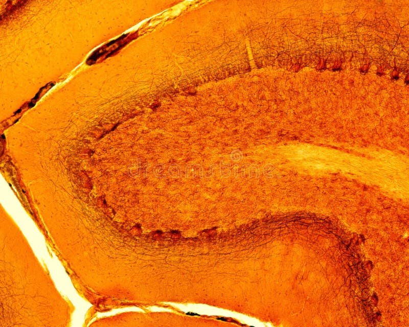 Cerebellar Cortex. Silver Stain Stock Photo - Image of matter, cells ...