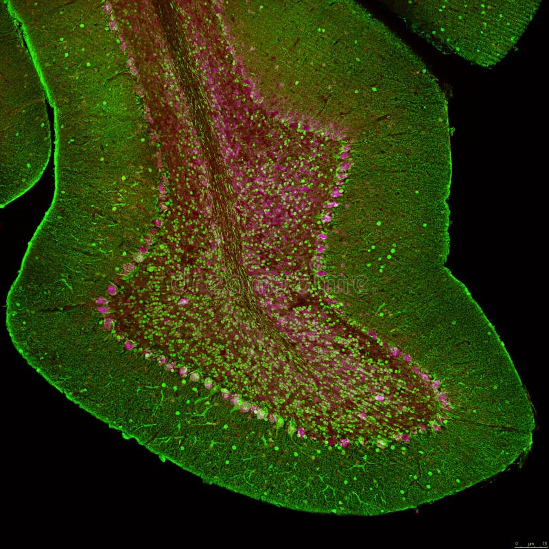 Cerebellar Folium, Confocal Image Stock Photo - Image of scanning ...