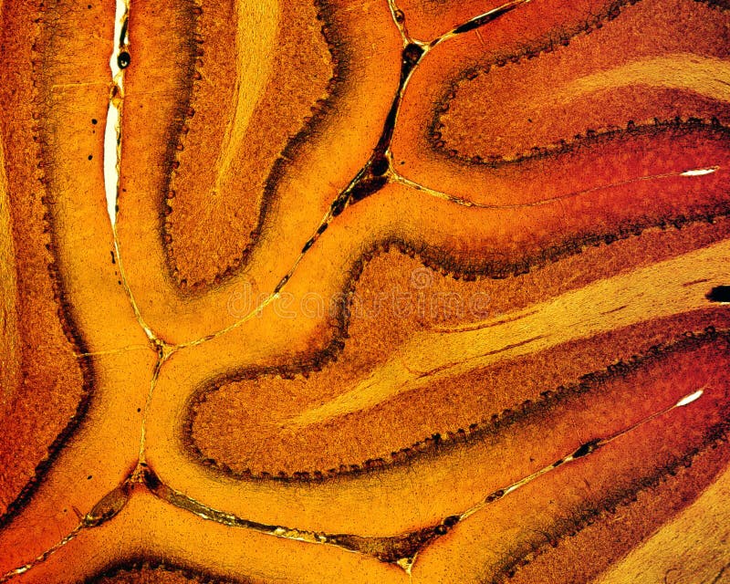 Cerebellum. Silver stain stock image. Image of neurology - 220382659