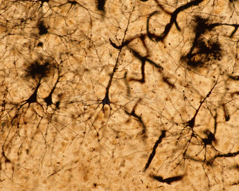 Cerebral Cortex. Pyramidal Neurons Stock Photo - Image of microscope ...