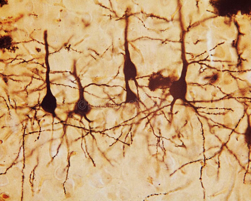 Pyramidal Neurons