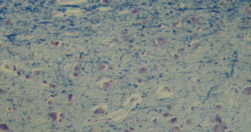 Cerebrum with nerve cells stock footage. Video of growth - 205891154
