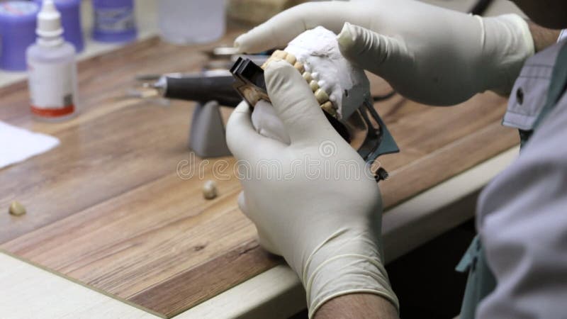 Cermet Implant Creation Process at Laboratory. Stock Video - Video of ...