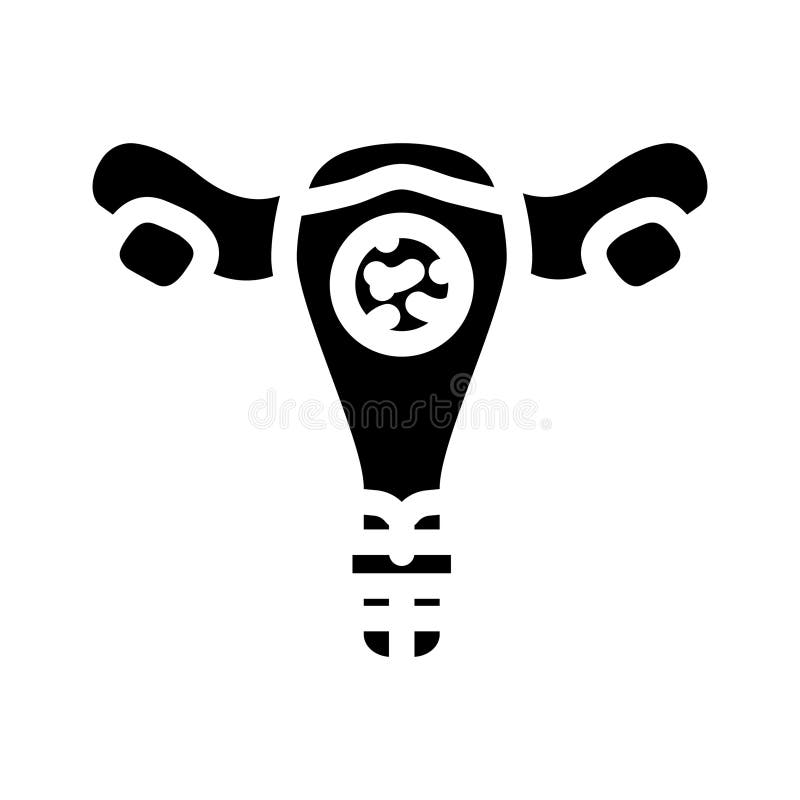 Cervical Cerclage Surgery Glyph Icon Vector Illustration Stock ...