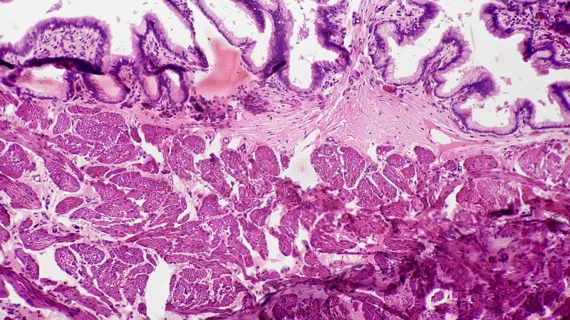 Cervix Section Filmed Under Light Micrograph with 400 Times ...