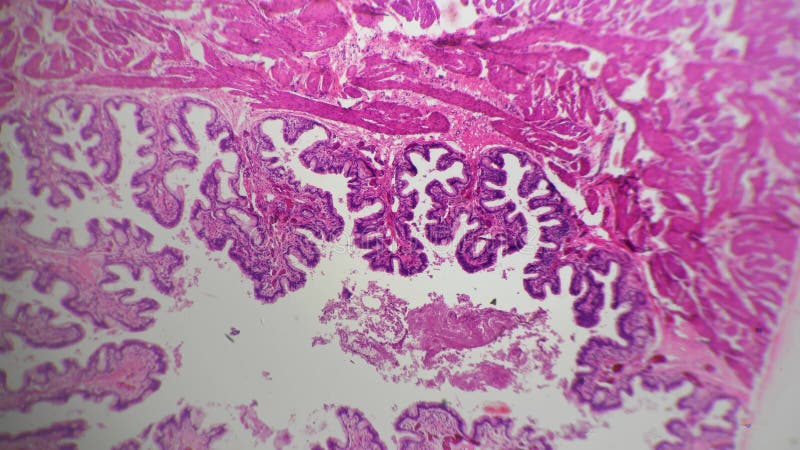 Cervix Section Filmed Under Light Micrograph With 200 Times