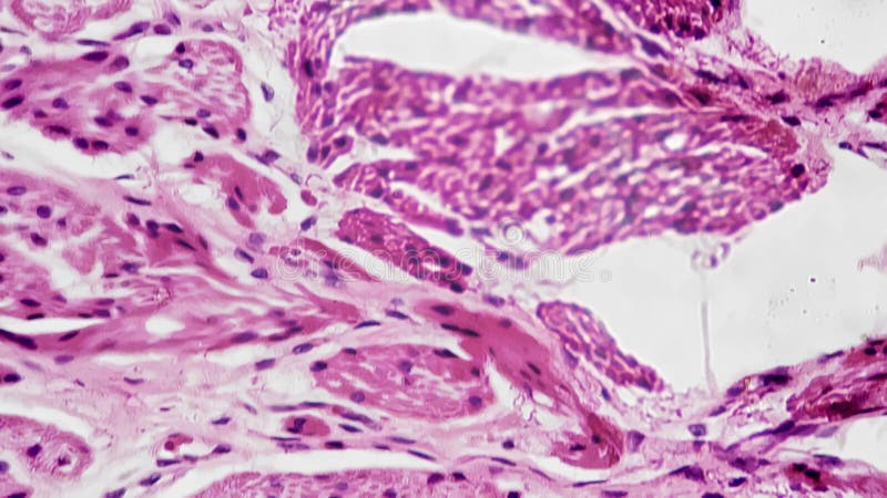 Cervix Section Filmed Under Light Micrograph with 200 Times ...