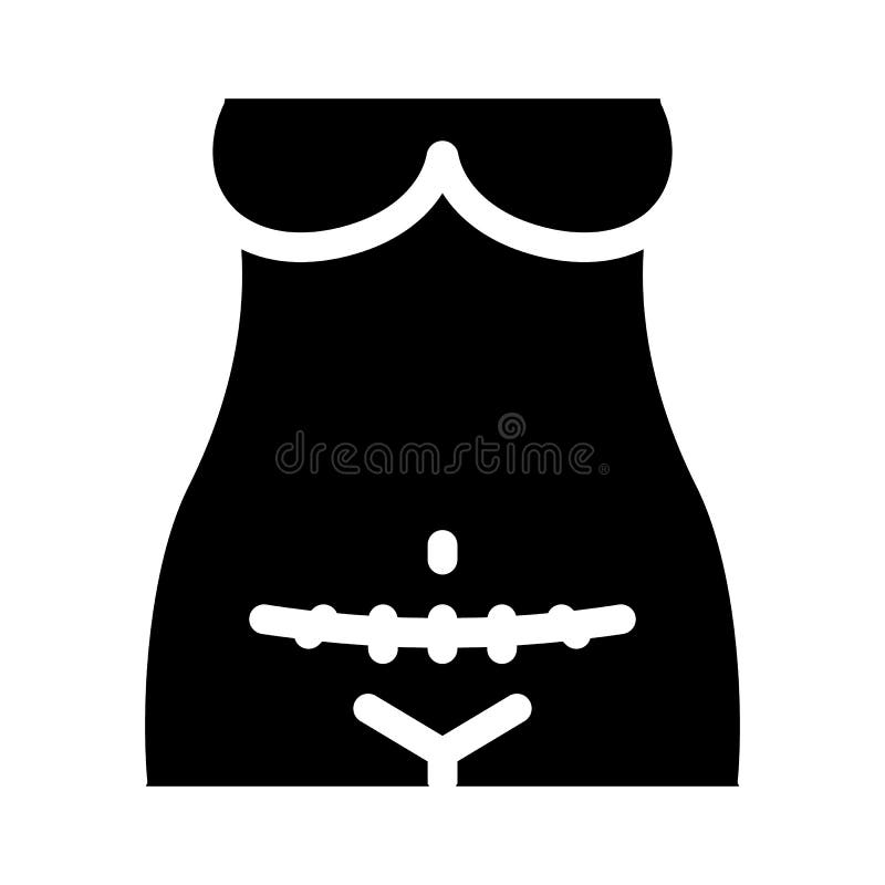 Cesarean Section Icon Vector Glyph Illustration Stock Vector ...