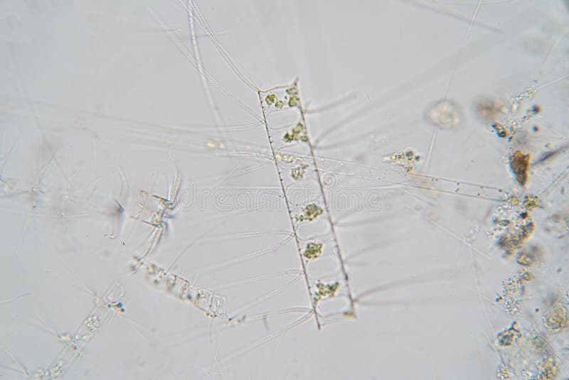Chaetoceros is Marine Planktonic Diatoms Under Microscope View Stock ...