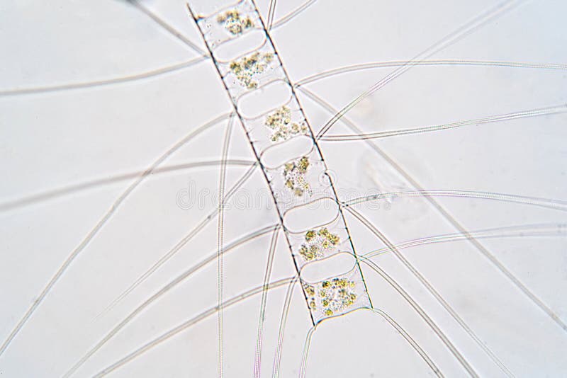 Chaetoceros is Marine Planktonic Diatoms Under Microscope View Stock ...