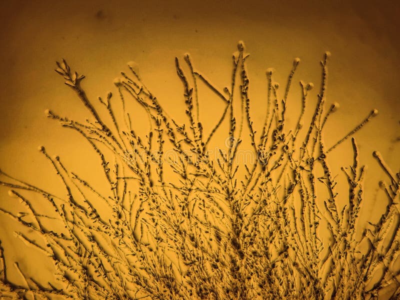 Champignon Dermatophyte Sous Le Microscope Photo stock - Image du ...