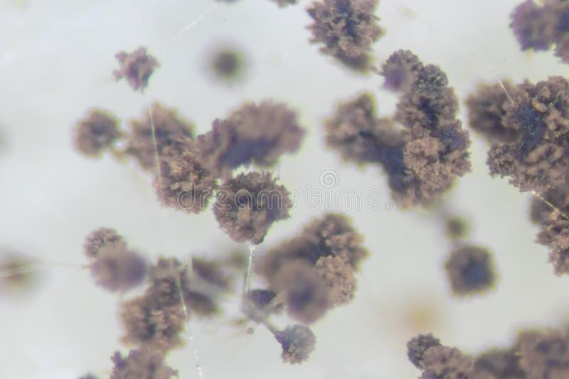 Champignons, Moule De Pain De Rhizopus Sous Le Microscope Photo stock ...