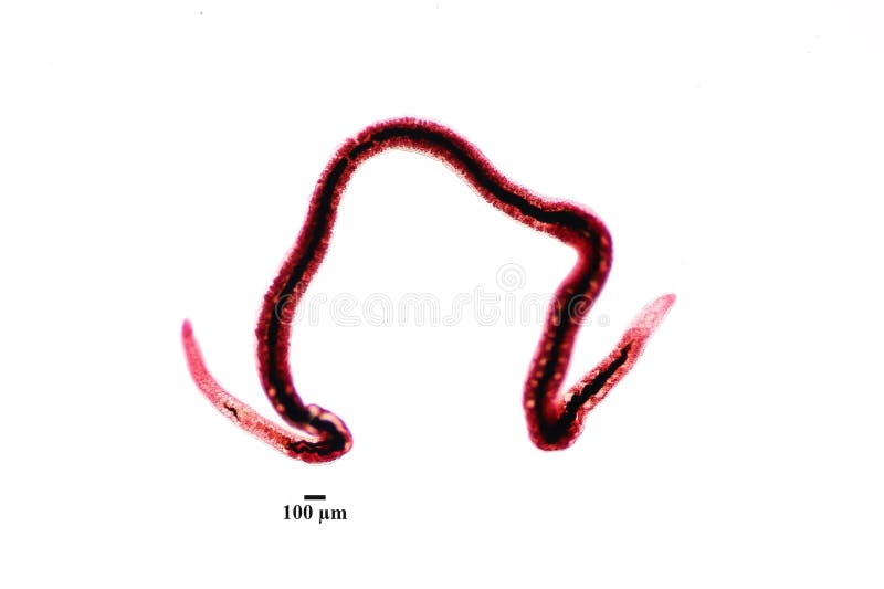 Thorny-headed Worms, or Spiny-headed Worms and Ascaris Under the ...