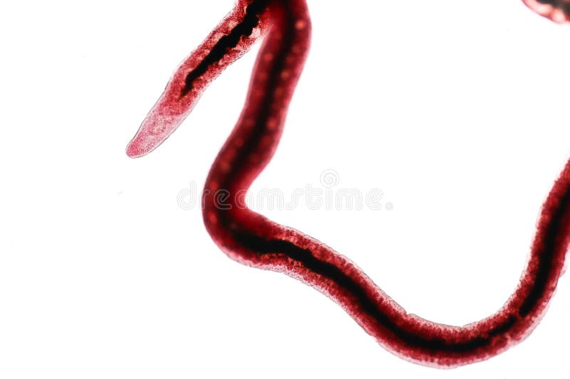 Thorny-headed Worms, or Spiny-headed Worms and Ascaris Under the ...