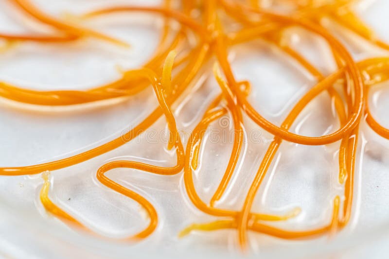 Thorny-headed Worms, or Spiny-headed Worms and Ascaris Under the ...