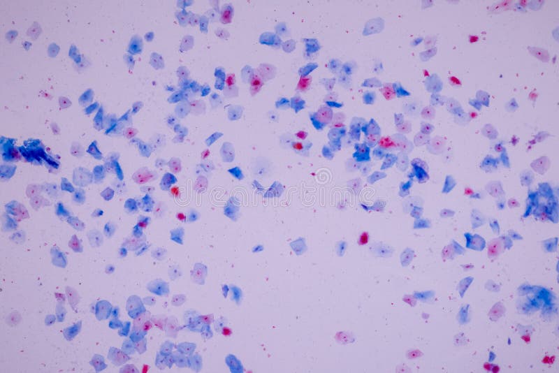 Histological Sample Squamous Epithelial Cells Under Microscope. Stock ...