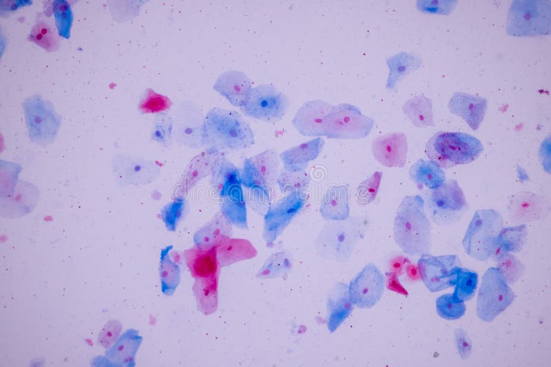 Histological Sample Squamous Epithelial Cells Under Microscope. Stock ...