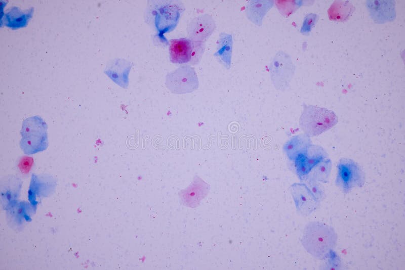Epithelial Cells Under Microscope Labeled