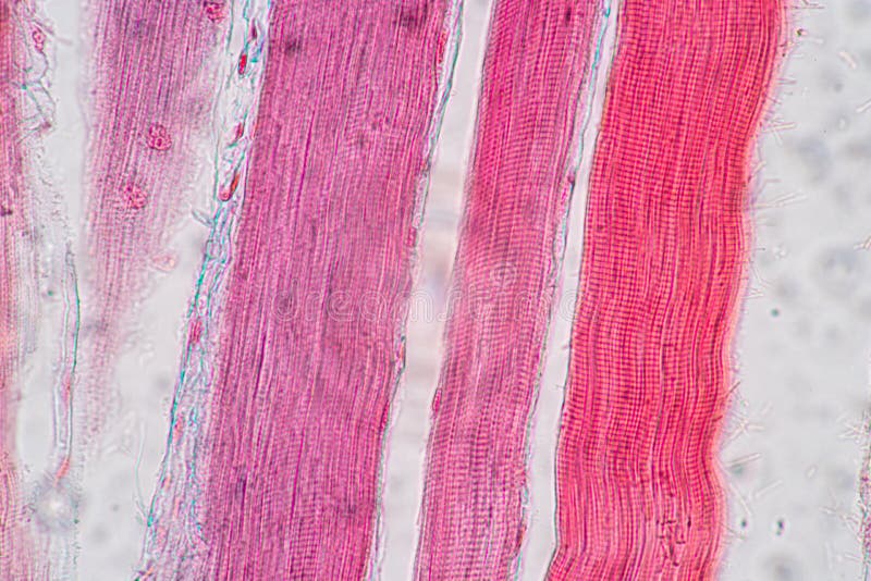 Skeletal Striated Muscle Tissue Under the Microscope Stock Image ...
