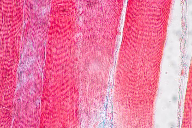 Histological Sample Striated Skeletal Muscle of Mammal Tissue Under the ...