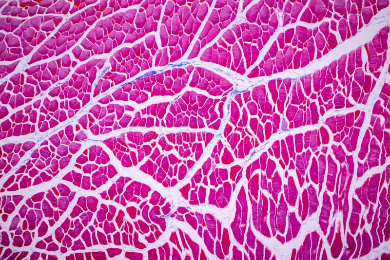 Histological Sample Striated Skeletal Muscle Of Mammal Tissue Under The ...