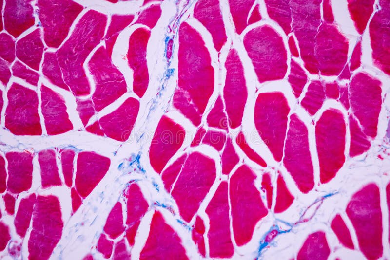 Histological Sample Striated Skeletal Muscle of Mammal Tissue Under the ...