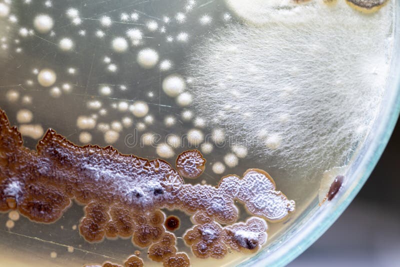 Characteristics and Different Shaped Colony of Bacteria and Mold ...