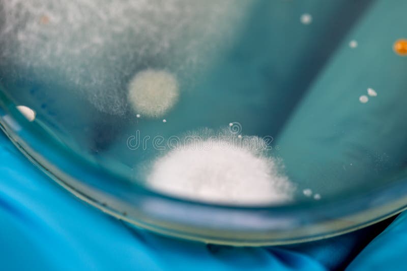 Characteristics and Different Shaped Colony of Bacteria and Mold ...