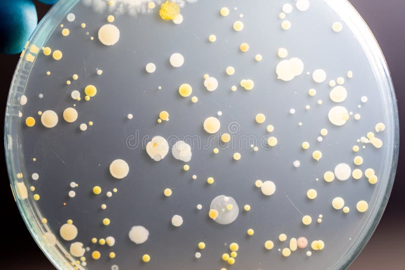 Characteristics and Different Shaped Colony of Bacteria and Mold ...