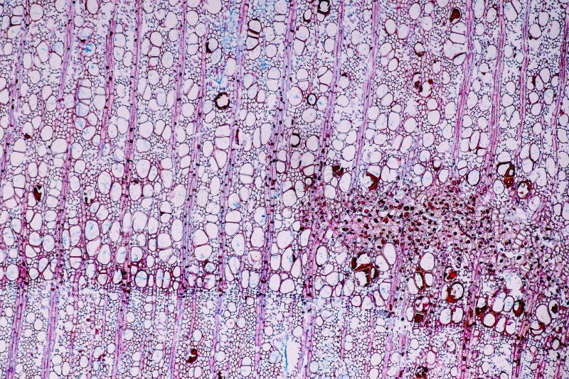 Fungi Living in Wood As a Group, are Polyphyletic Under the Microscope ...