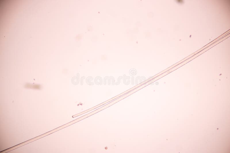 Hair Cell of Human Under Microscope View. Stock Image - Image of ...