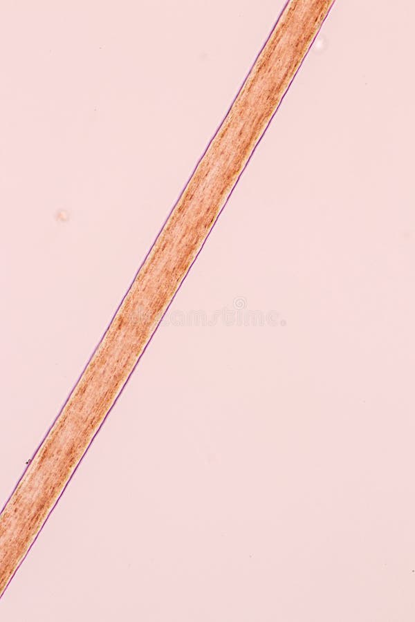 Hair Cell of Human Under Microscope View. Stock Photo - Image of ...