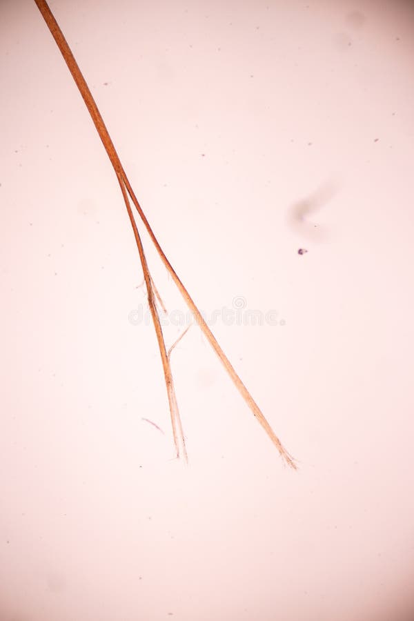 Hair Cell of Human Under Microscope View. Stock Photo - Image of dermis ...