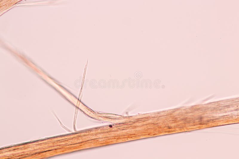 Hair Cell of Human Under Microscope View. Stock Photo - Image of ...