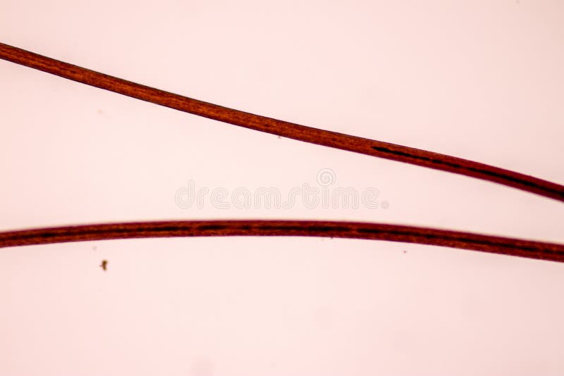 Red Hair Under Microscope